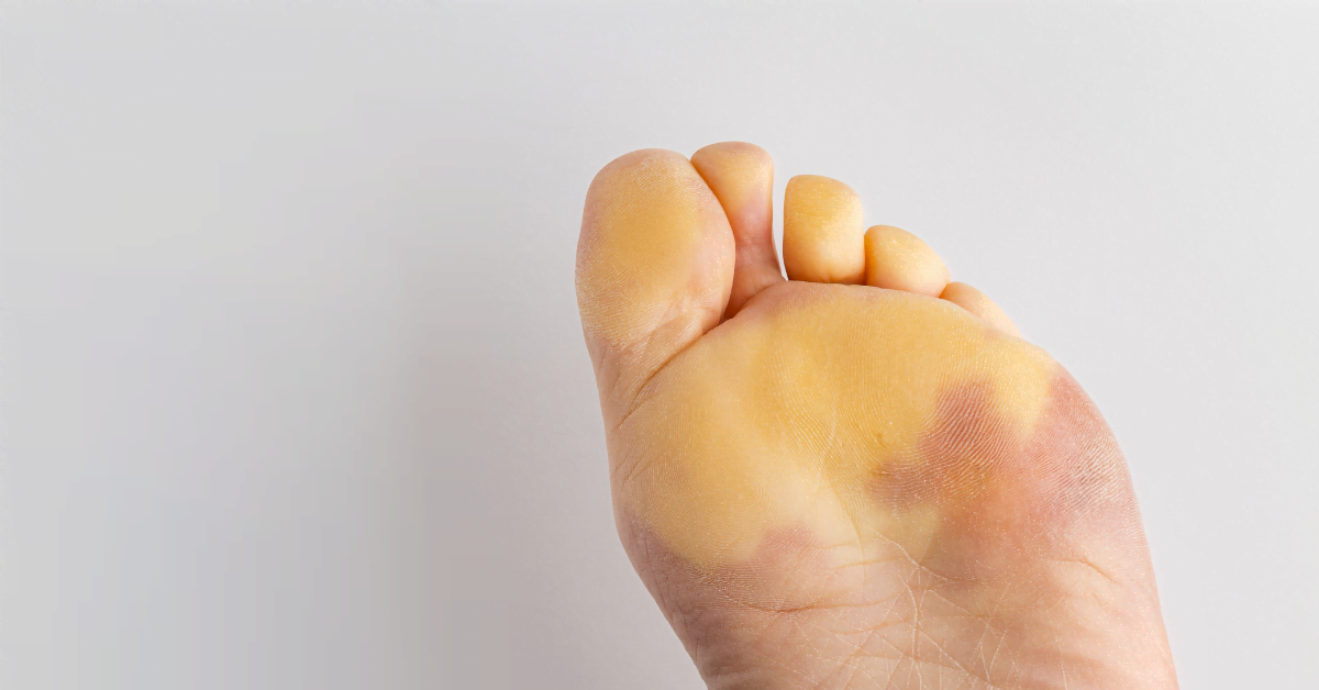 Pieds froids | Que pouvez-vous faire immédiatement ? | 7 conseils